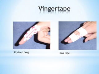 Basic principles of taping techniques - Mr. Marc Lievens | PPTX