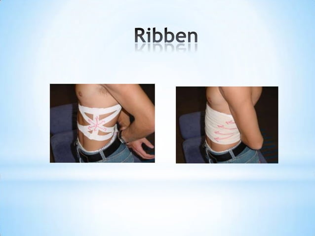 Basic principles of taping techniques - Mr. Marc Lievens | PPTX