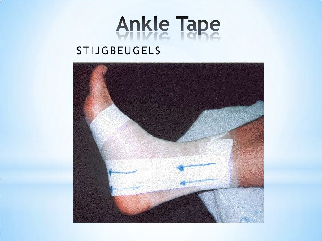 Basic principles of taping techniques - Mr. Marc Lievens