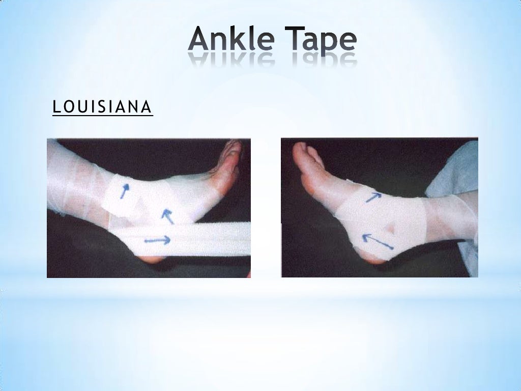 Basic principles of taping techniques - Mr. Marc Lievens