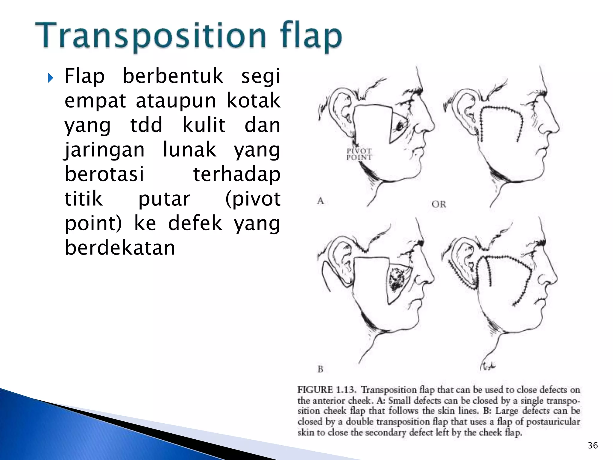 Basic principles plastic surgery | PPTX