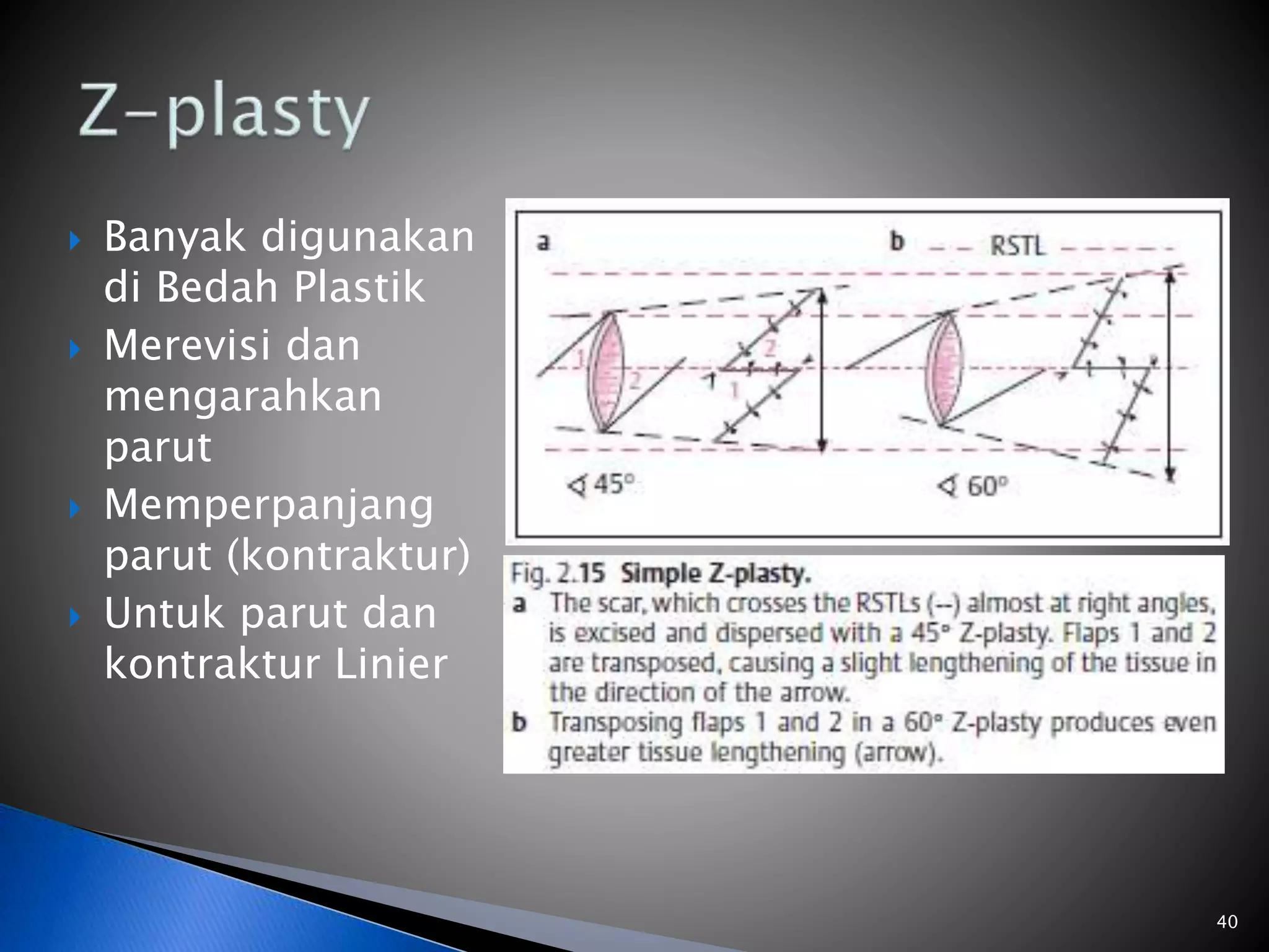 Basic principles plastic surgery | PPTX