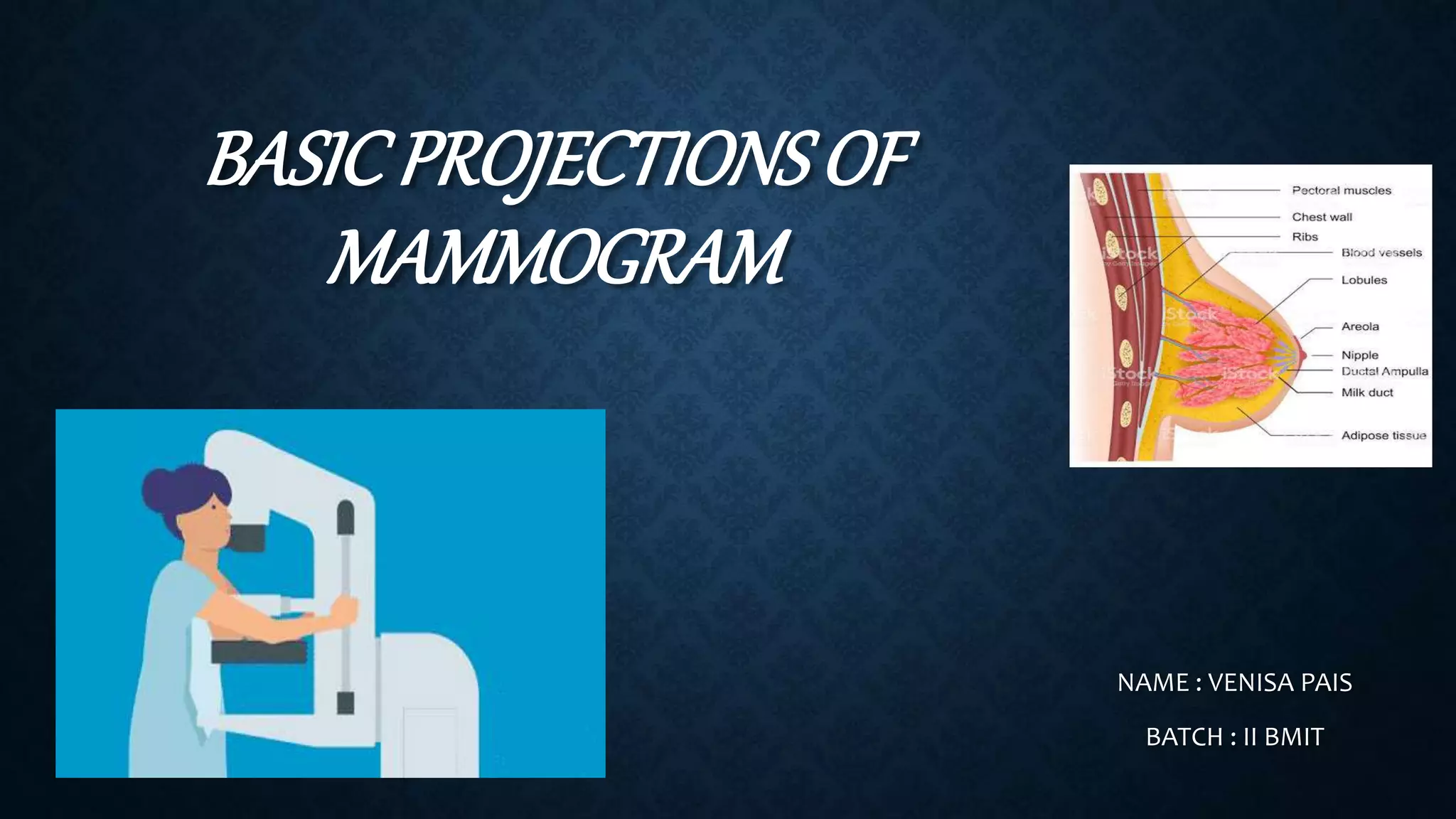 Basic projections of mammogram | PPTX