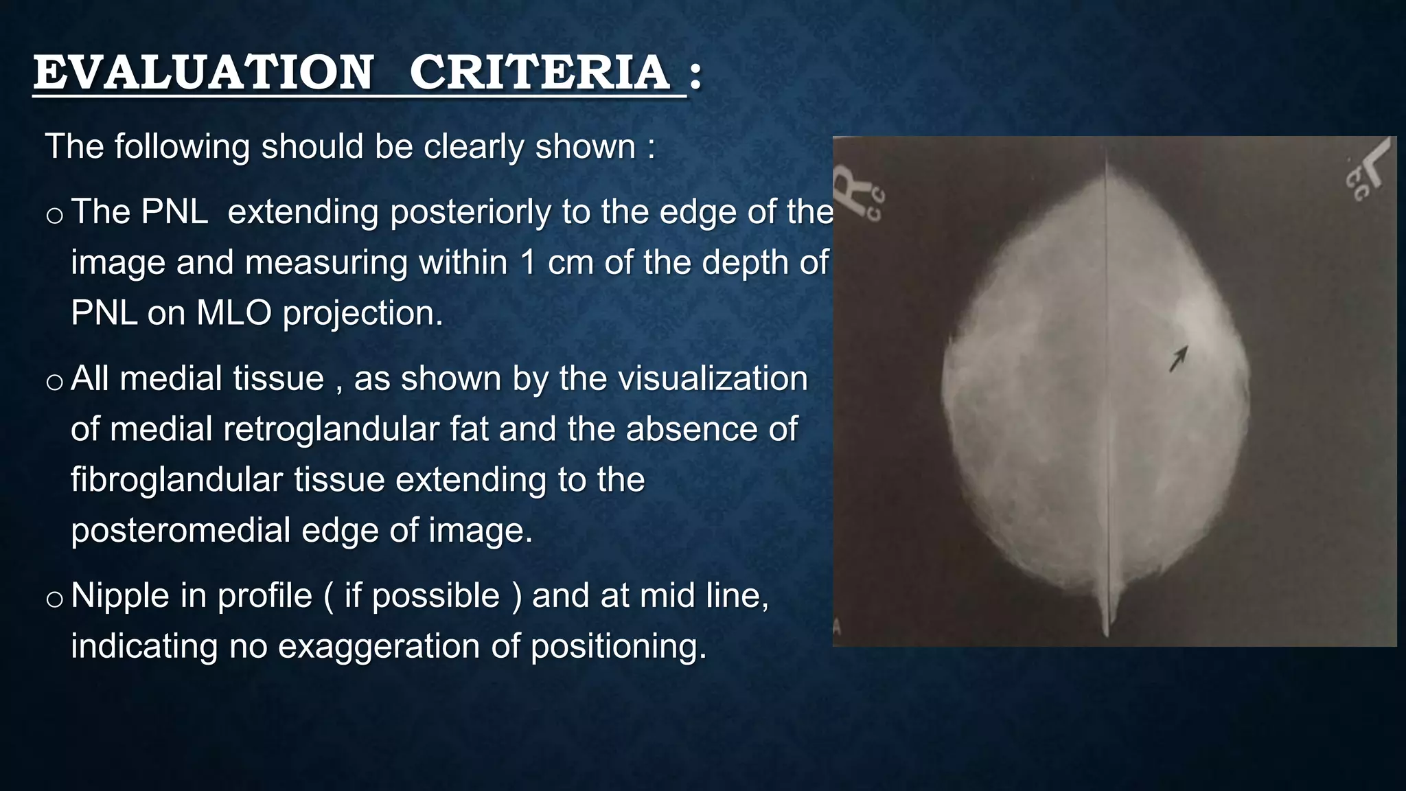 Basic projections of mammogram | PPTX