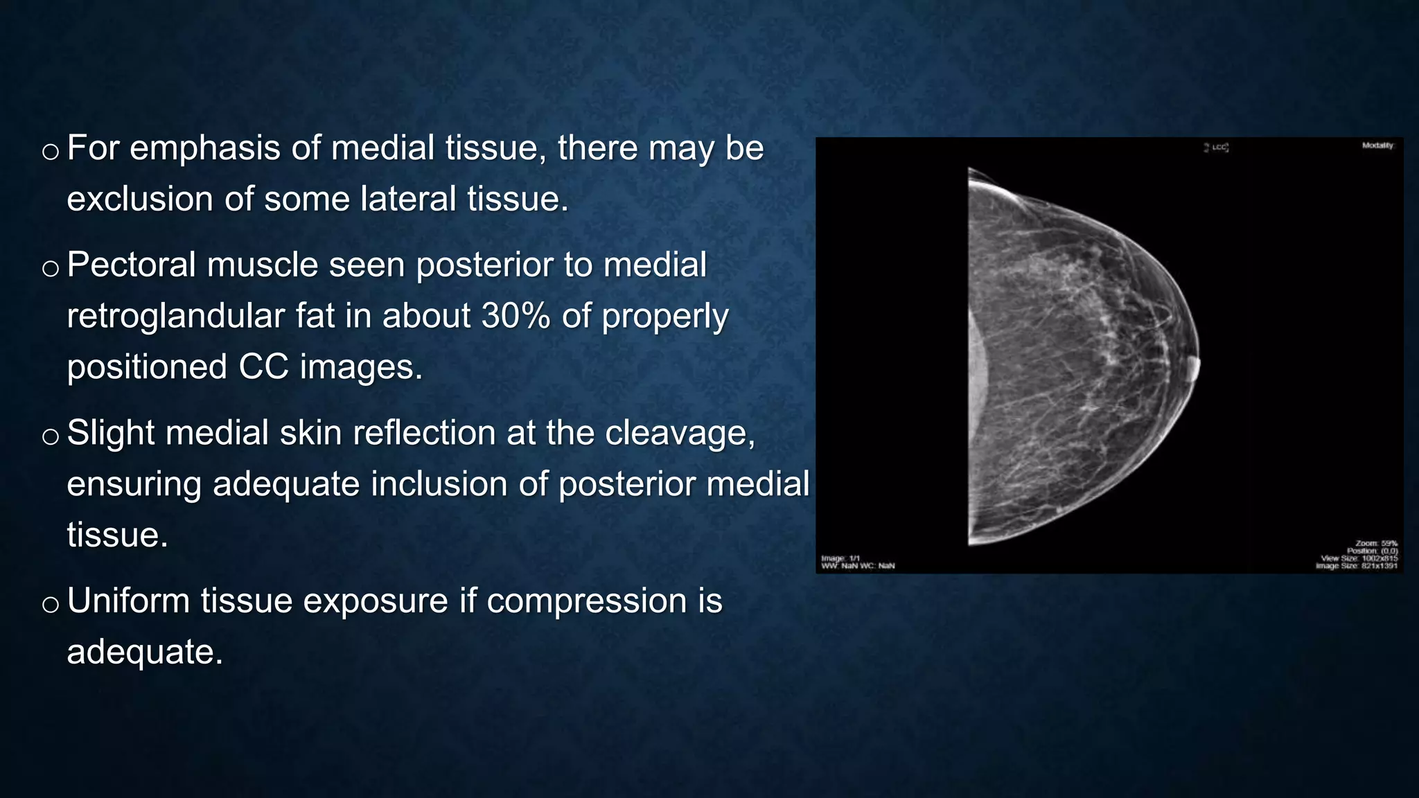 Basic projections of mammogram | PPTX