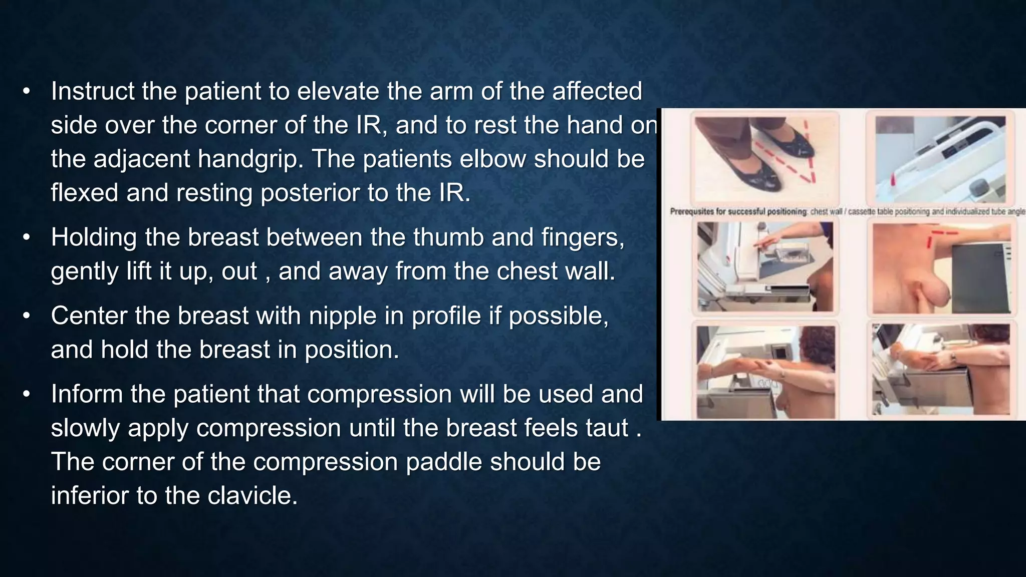 Basic projections of mammogram | PPTX