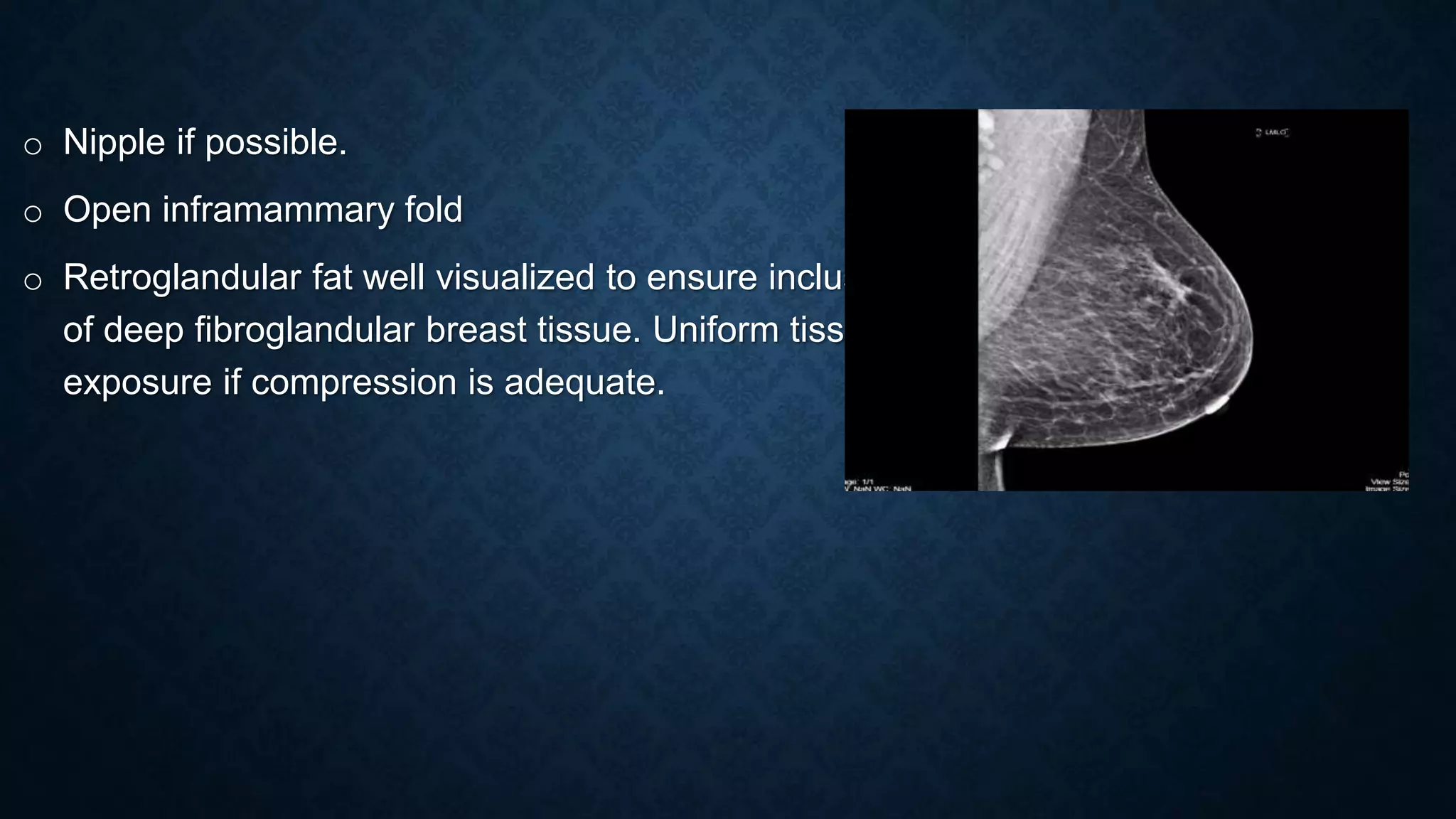 Basic projections of mammogram | PPTX