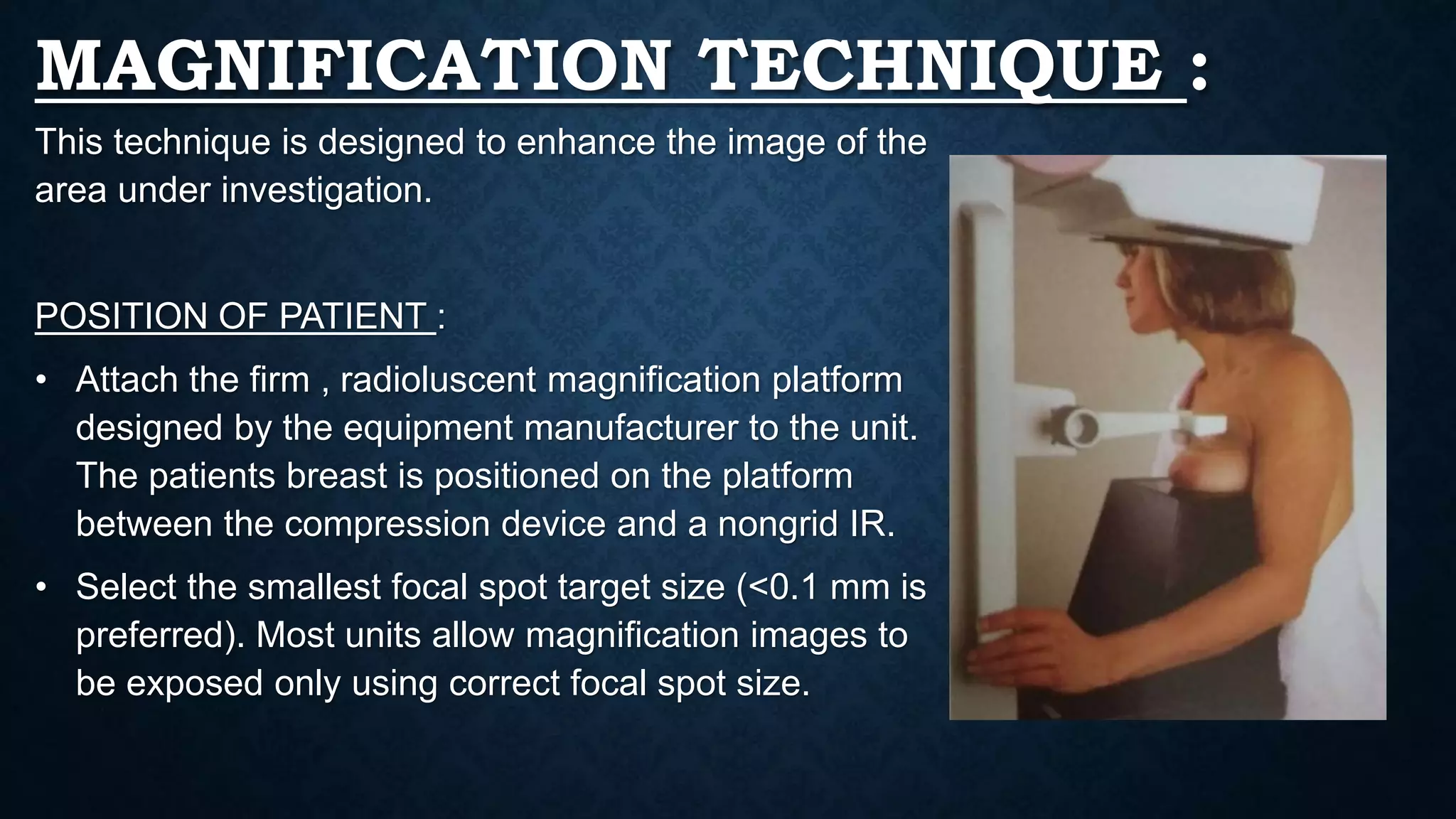 Basic projections of mammogram | PPTX