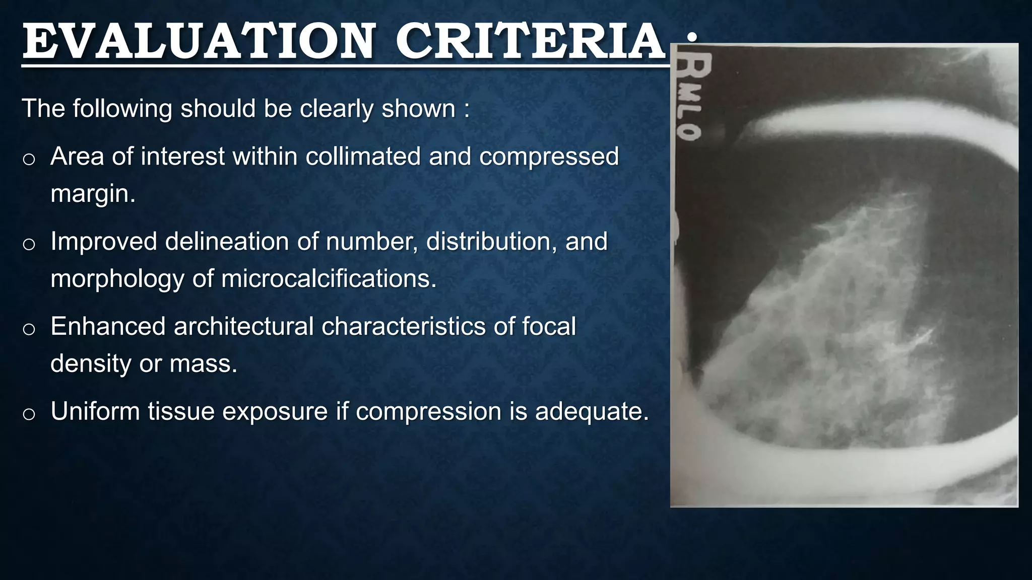 Basic projections of mammogram | PPTX