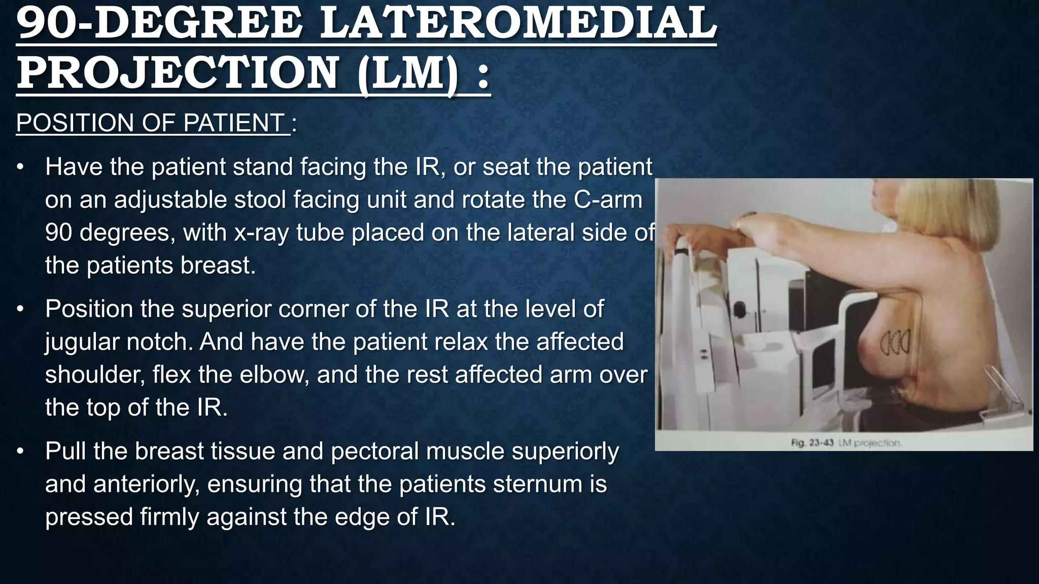 Basic projections of mammogram | PPTX