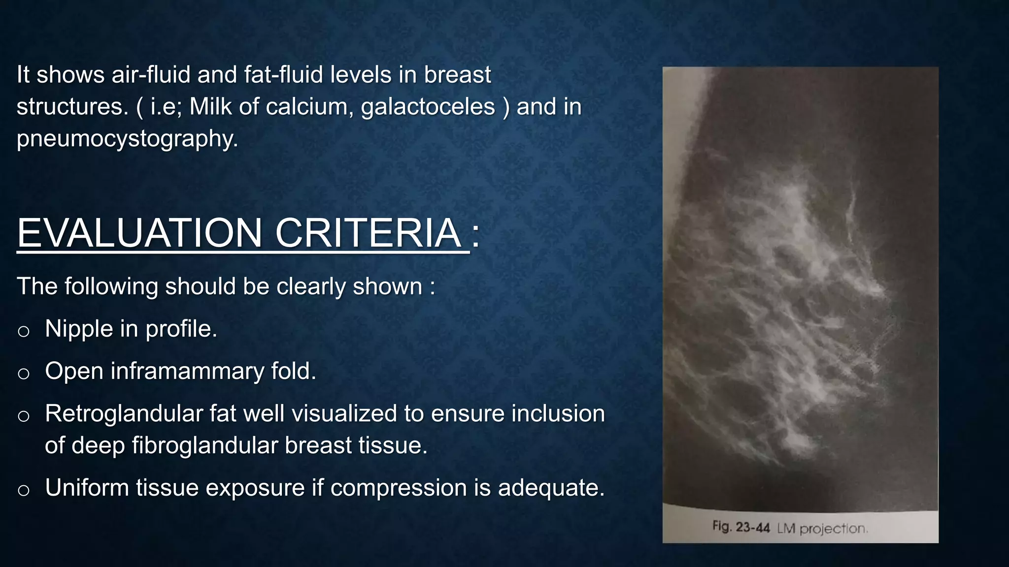 Basic projections of mammogram | PPTX