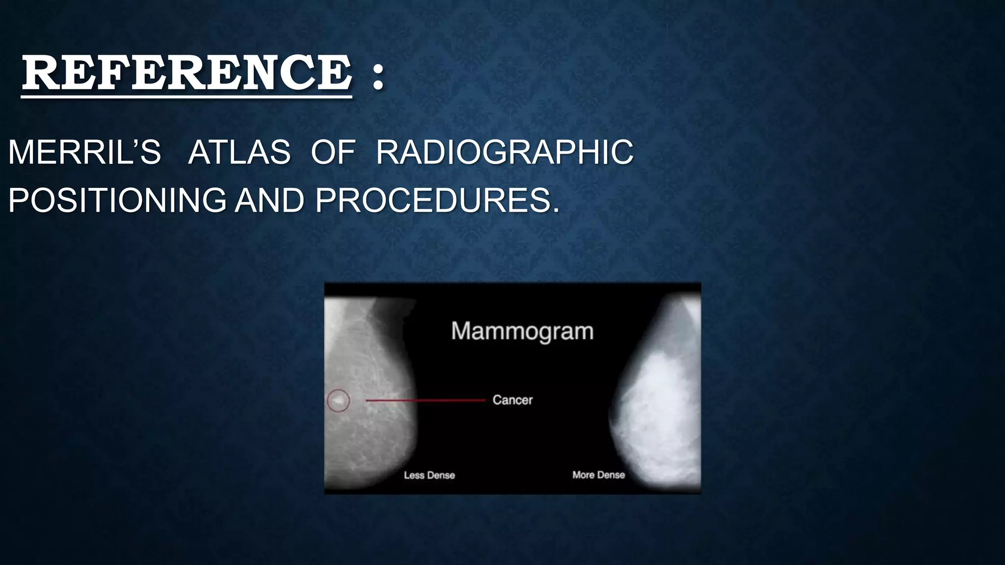 Basic projections of mammogram | PPTX