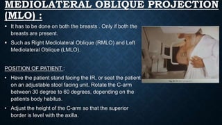 Basic projections of mammogram | PPTX