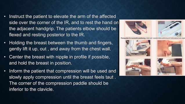 Basic projections of mammogram | PPTX | Medical Tests | Medical Health