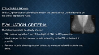 Basic projections of mammogram | PPTX