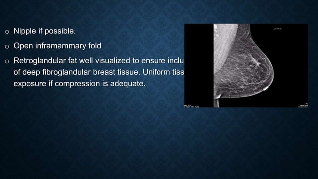 Basic projections of mammogram | PPTX | Medical Tests | Medical Health