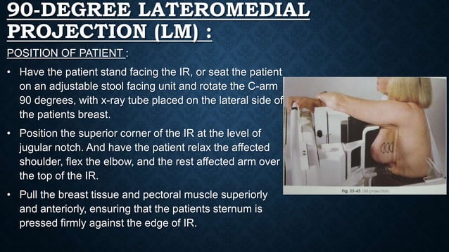 Basic projections of mammogram | PPTX | Medical Tests | Medical Health