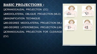 Basic projections of mammogram | PPTX