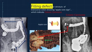 Basic Radiology course.pdfbbVavaavabhhgg | PDF