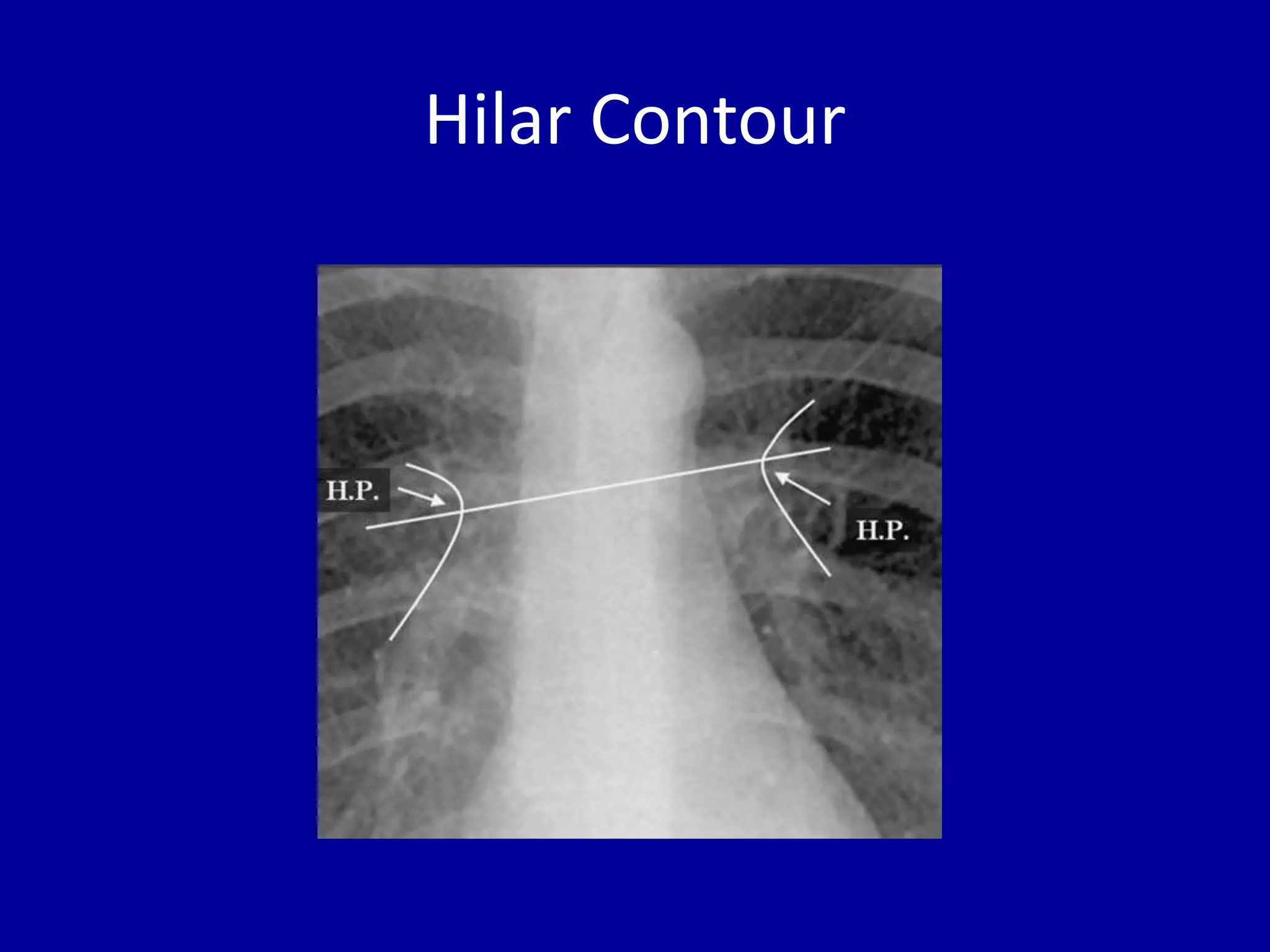 Basic radiology for non radiologist | PPTX
