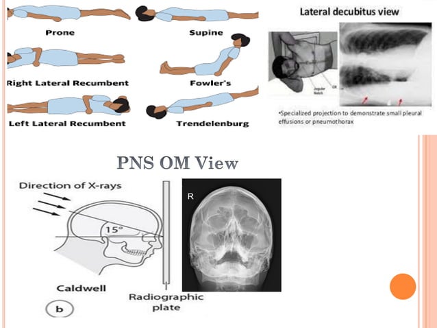 Basic radiology & imaging-PDF..pdf