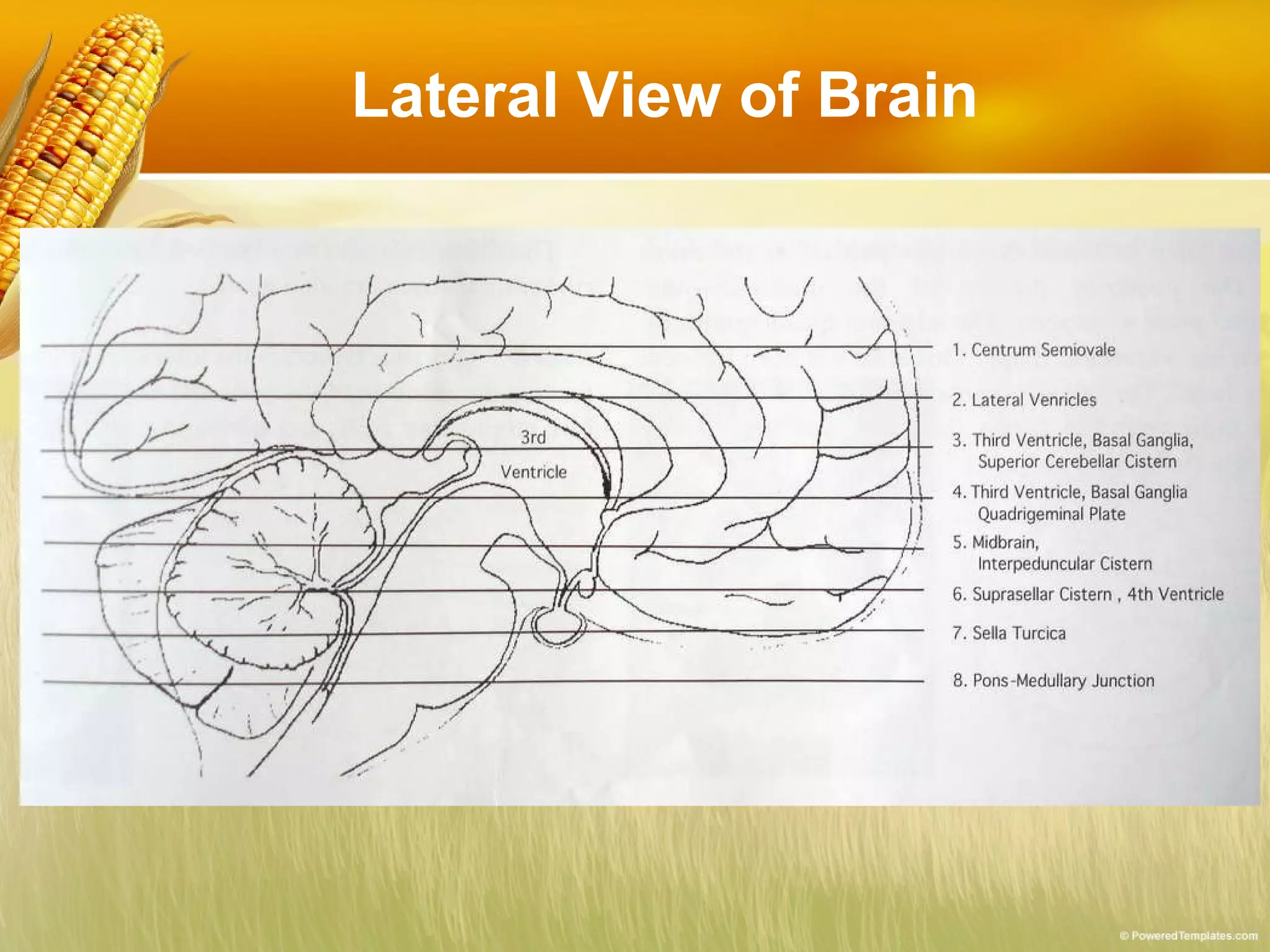 Basic reading computed tomography (ct) of brain | PPT