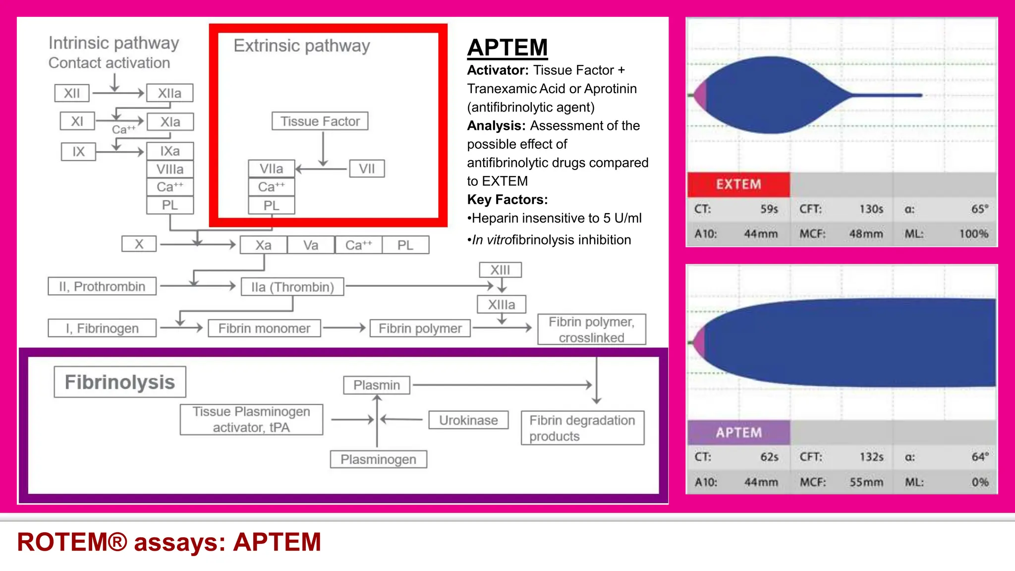 Basic Rotational ThromboelastometryROTEM | PPTX