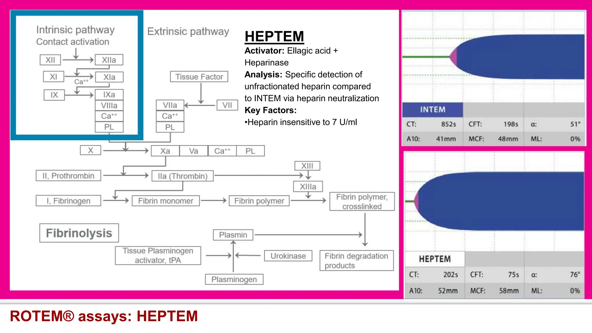Basic Rotational ThromboelastometryROTEM | PPTX