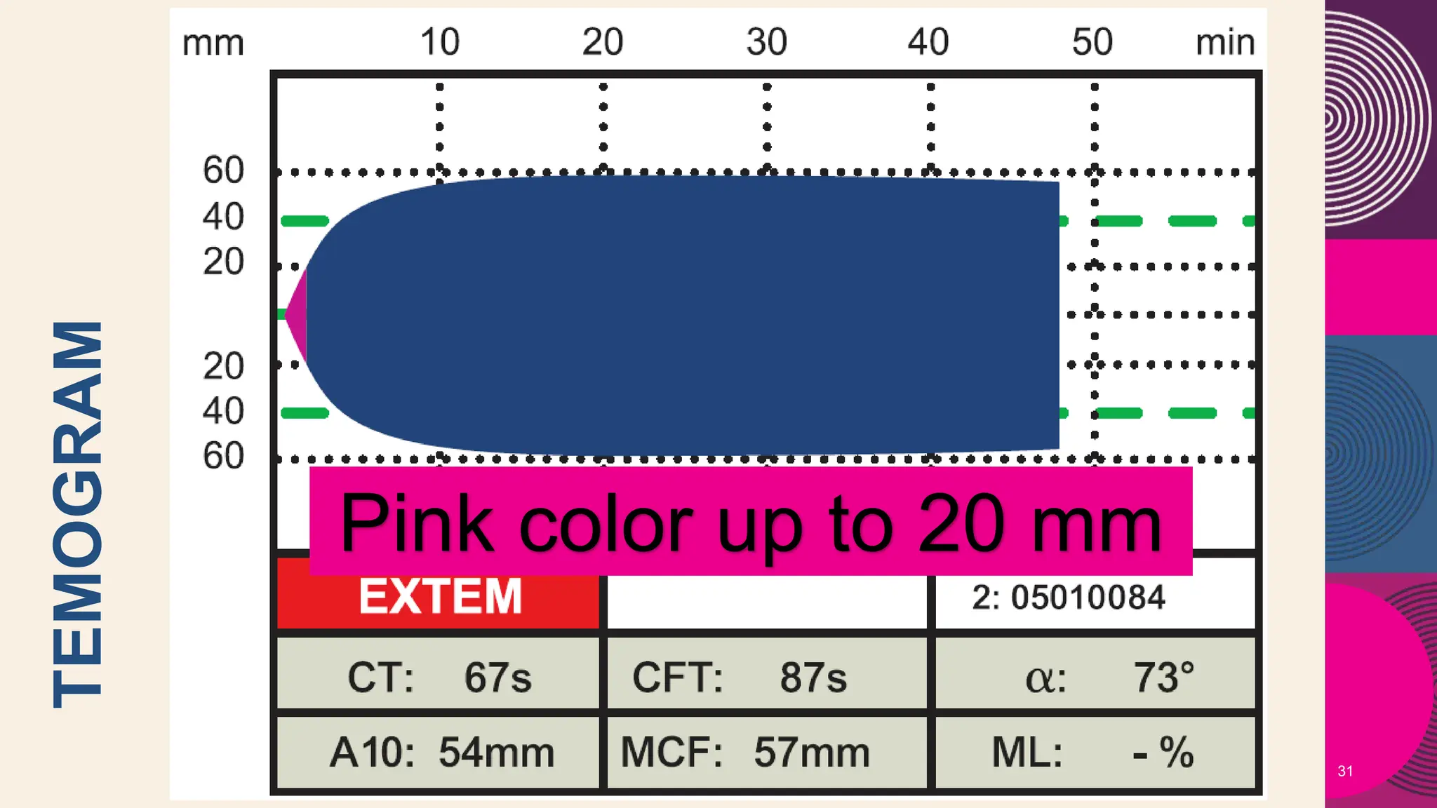 Basic Rotational ThromboelastometryROTEM | PPTX