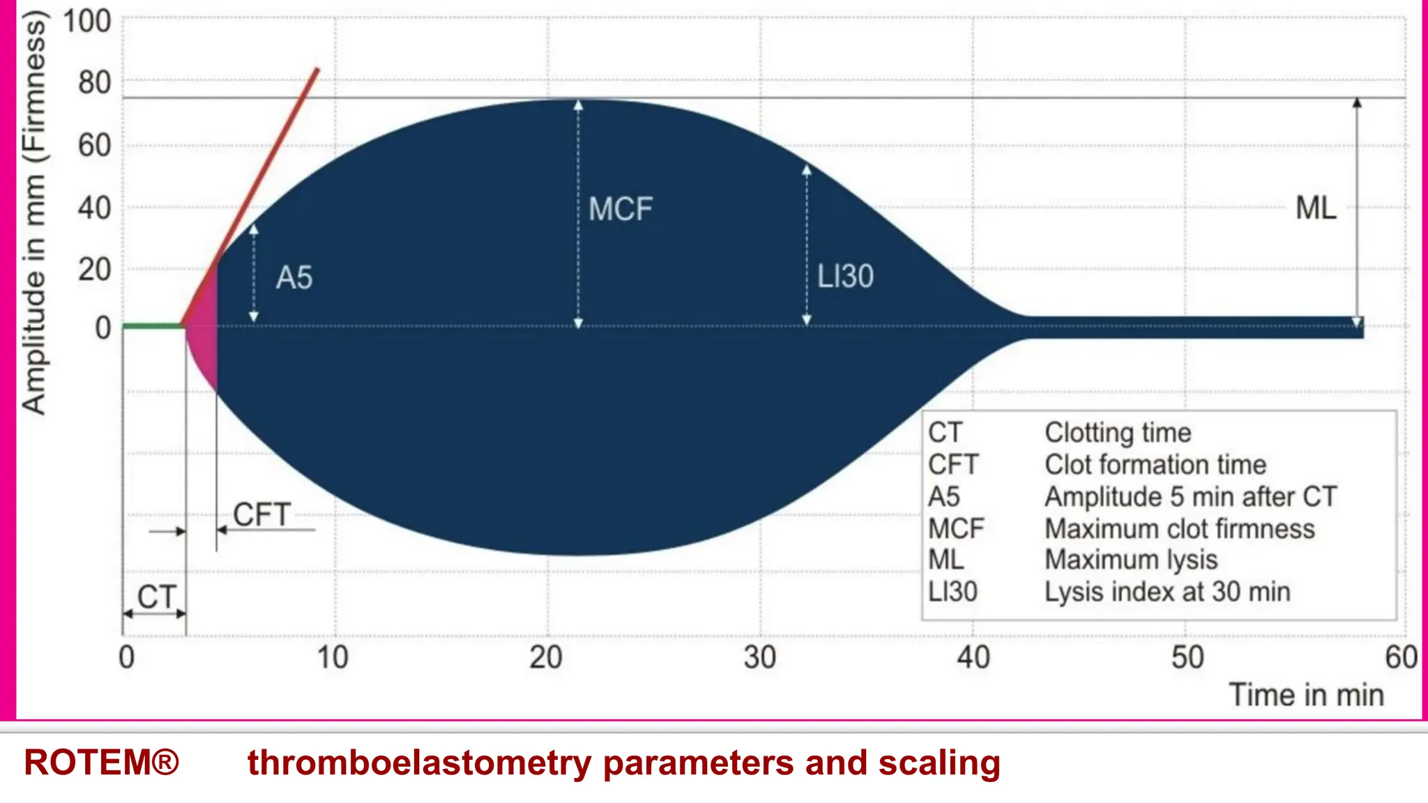Basic Rotational ThromboelastometryROTEM | PPTX