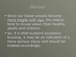 Basics of First aid for children in Middle School | KEY