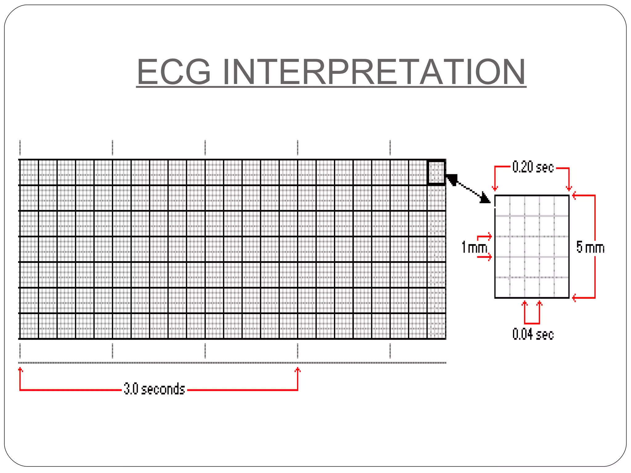 Basics of ECG | PPT