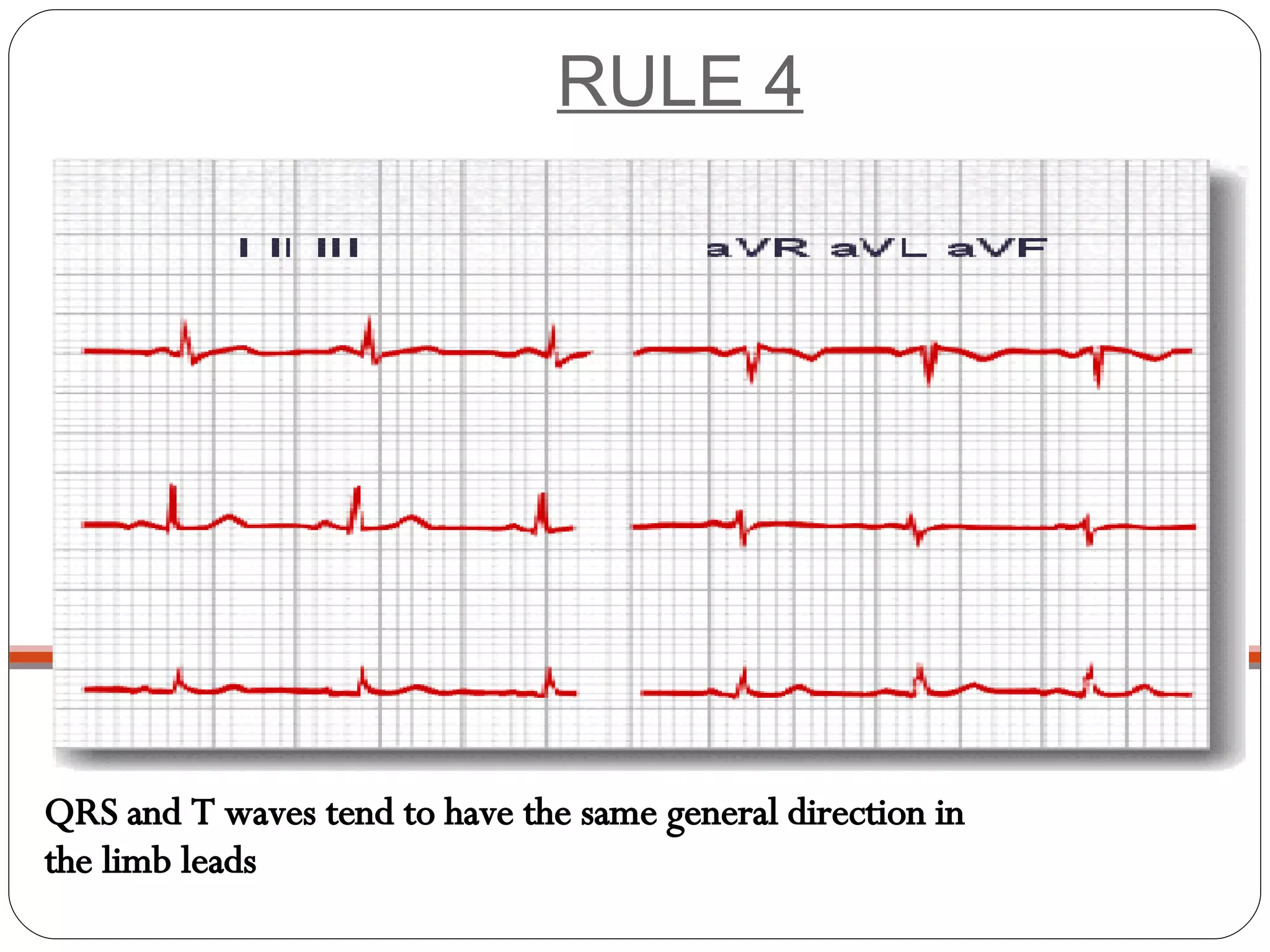 Basics of ECG | PPT