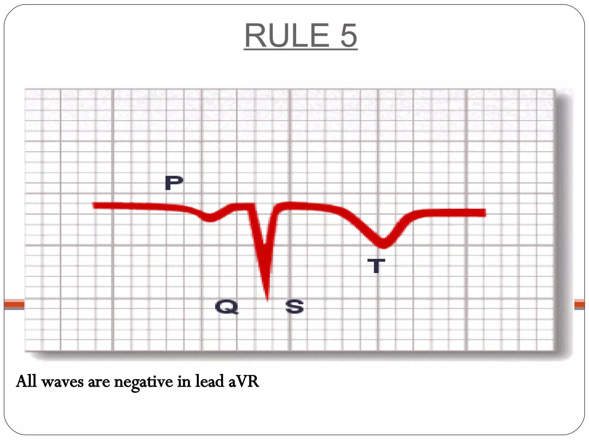 Basics of ECG | PPT