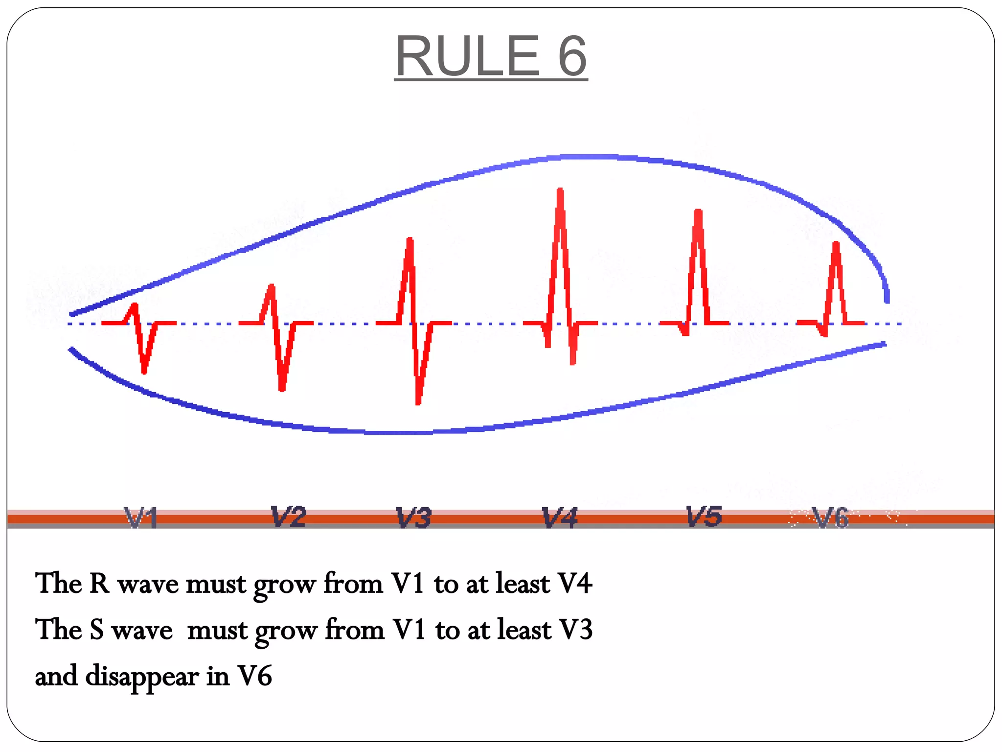 Basics of ECG | PPT