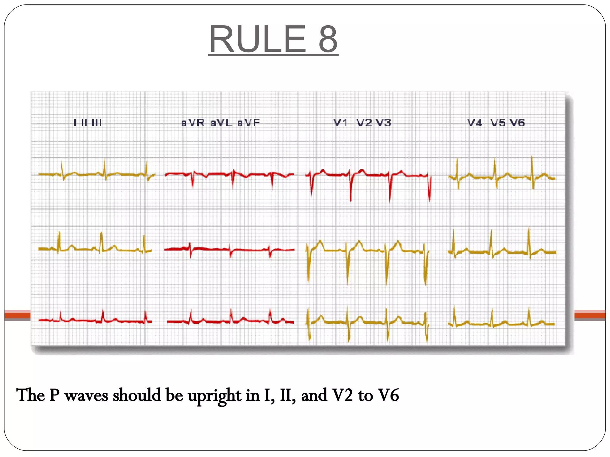Basics of ECG | PPT