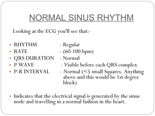 Basics of ECG | PPT