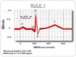 Basics of ECG | PPT