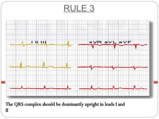 Basics of ECG | PPT
