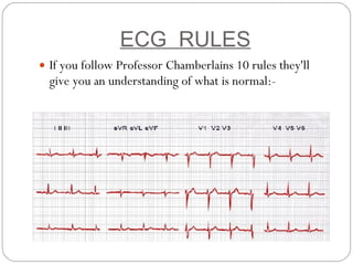 Basics of ECG