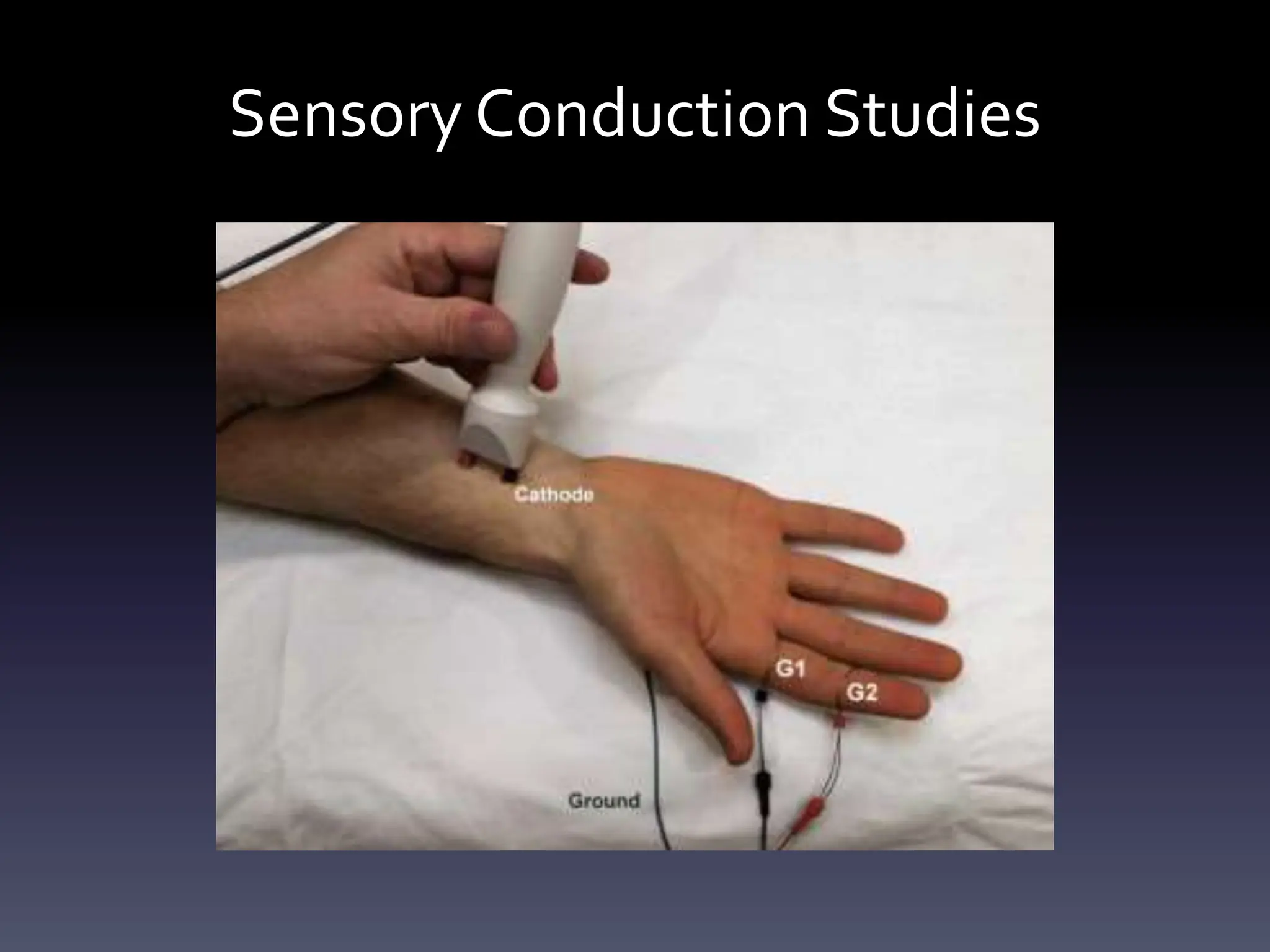 ncs study - basics of nerve conduction study | PPTX