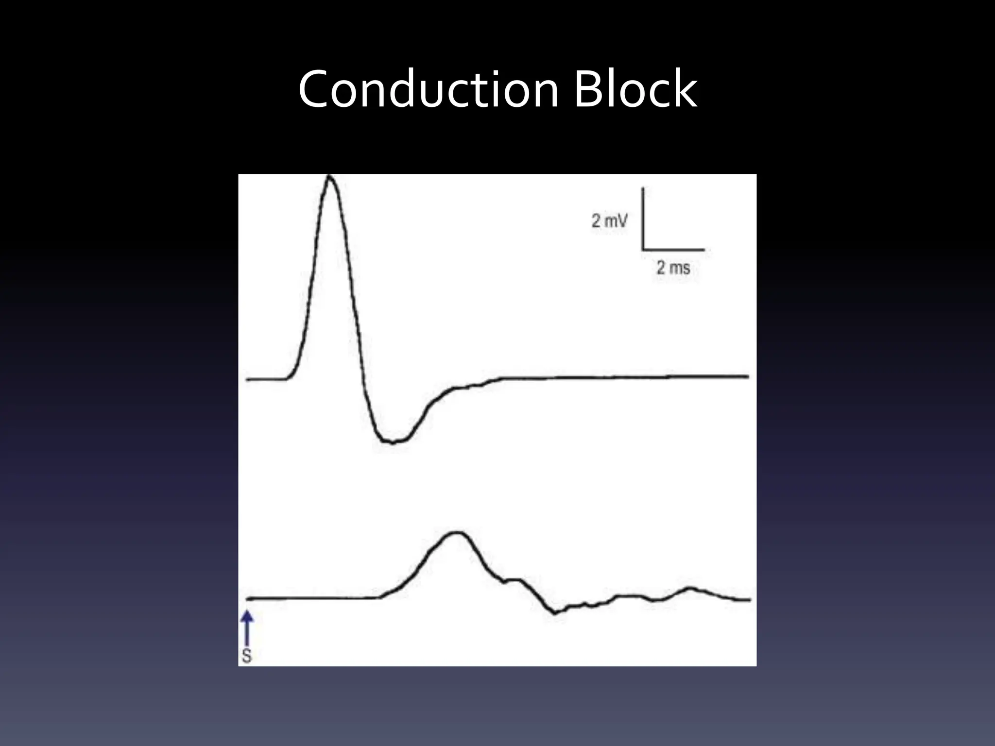 ncs study - basics of nerve conduction study | PPTX