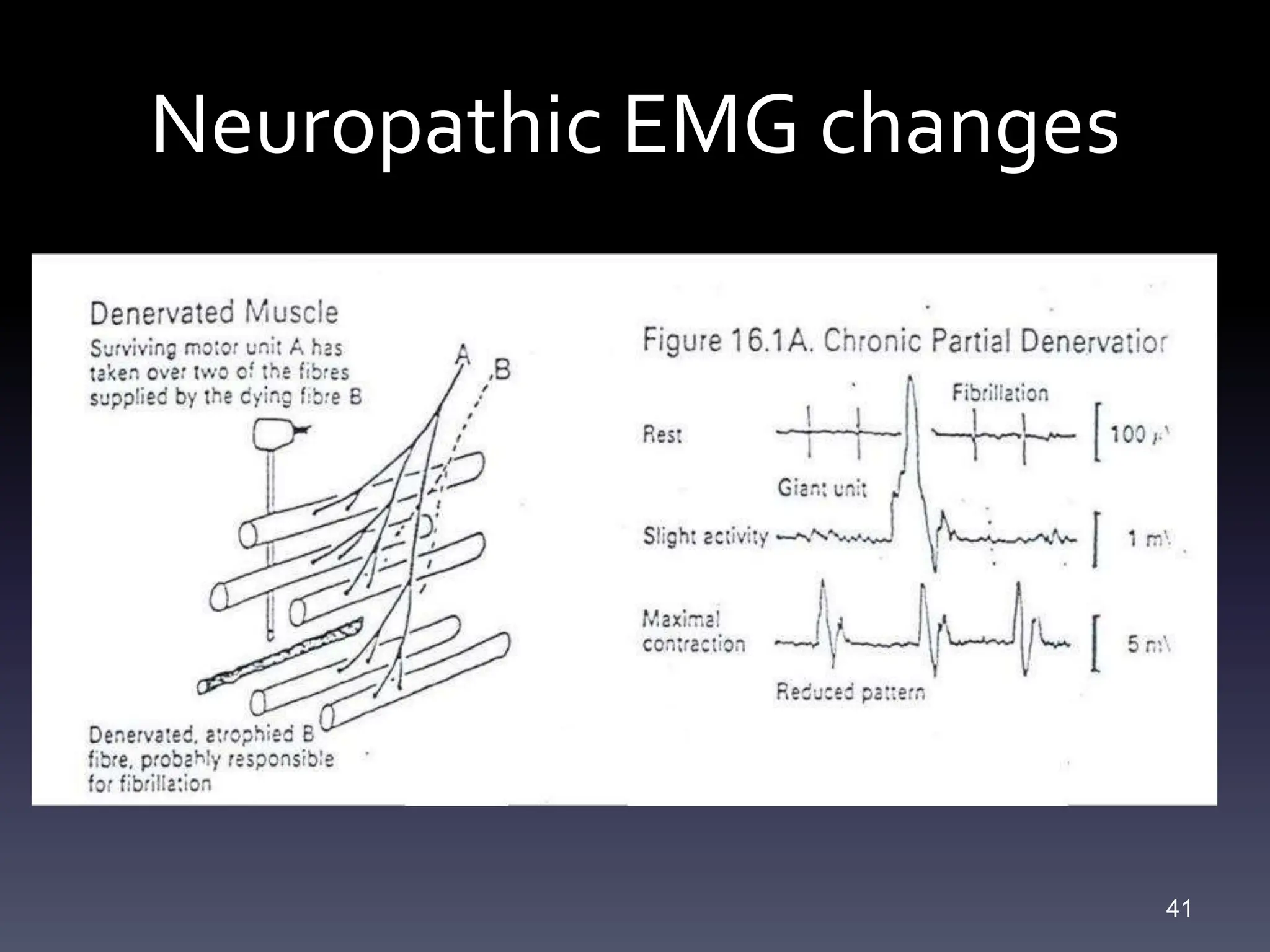 ncs study - basics of nerve conduction study | PPTX | Brain and Nervous ...
