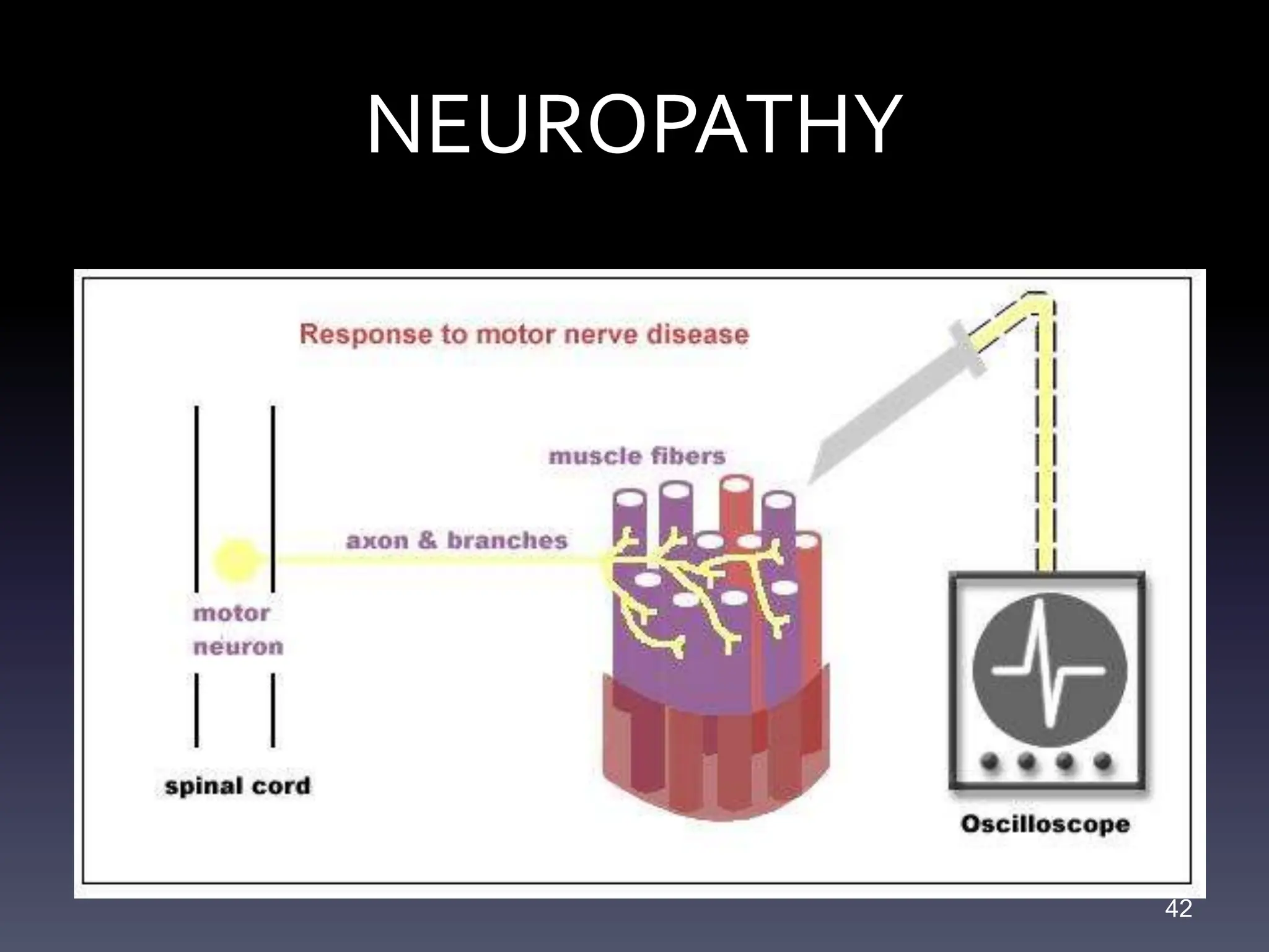 ncs study - basics of nerve conduction study | PPTX