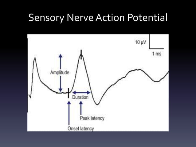 ncs study - basics of nerve conduction study | PPTX | Brain and Nervous ...