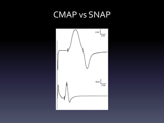 ncs study - basics of nerve conduction study | PPTX | Brain and Nervous ...