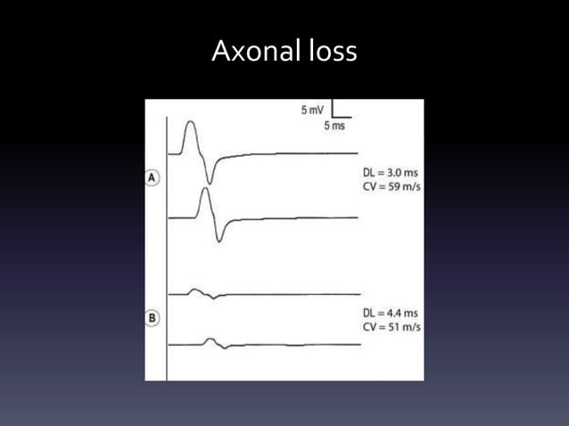 ncs study - basics of nerve conduction study | PPTX | Brain and Nervous ...