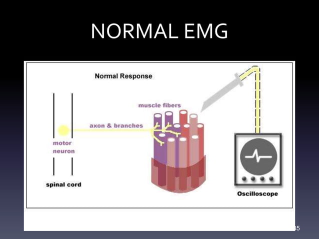 ncs study - basics of nerve conduction study | PPTX | Brain and Nervous ...