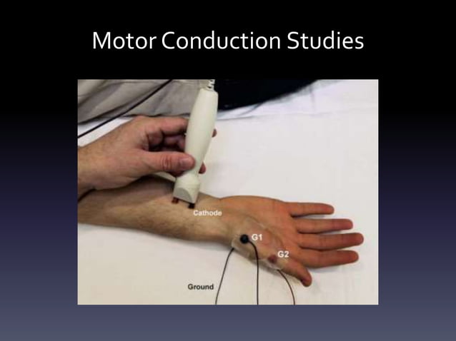 ncs study - basics of nerve conduction study | PPTX | Brain and Nervous ...
