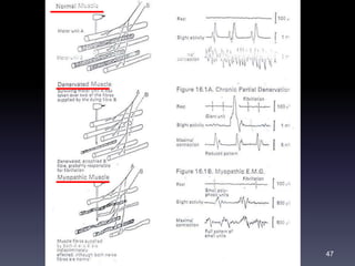 ncs study - basics of nerve conduction study | PPTX